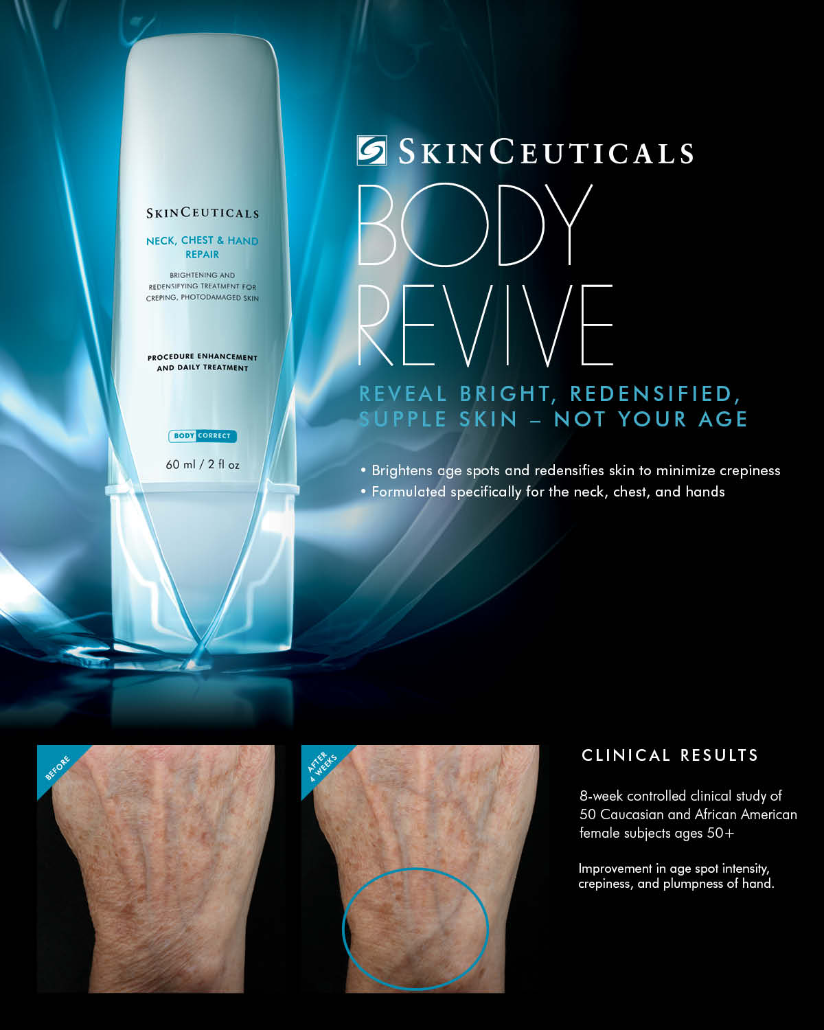 SkinCeuticals Body Correct Line Now Available at Skin Envy - News ...