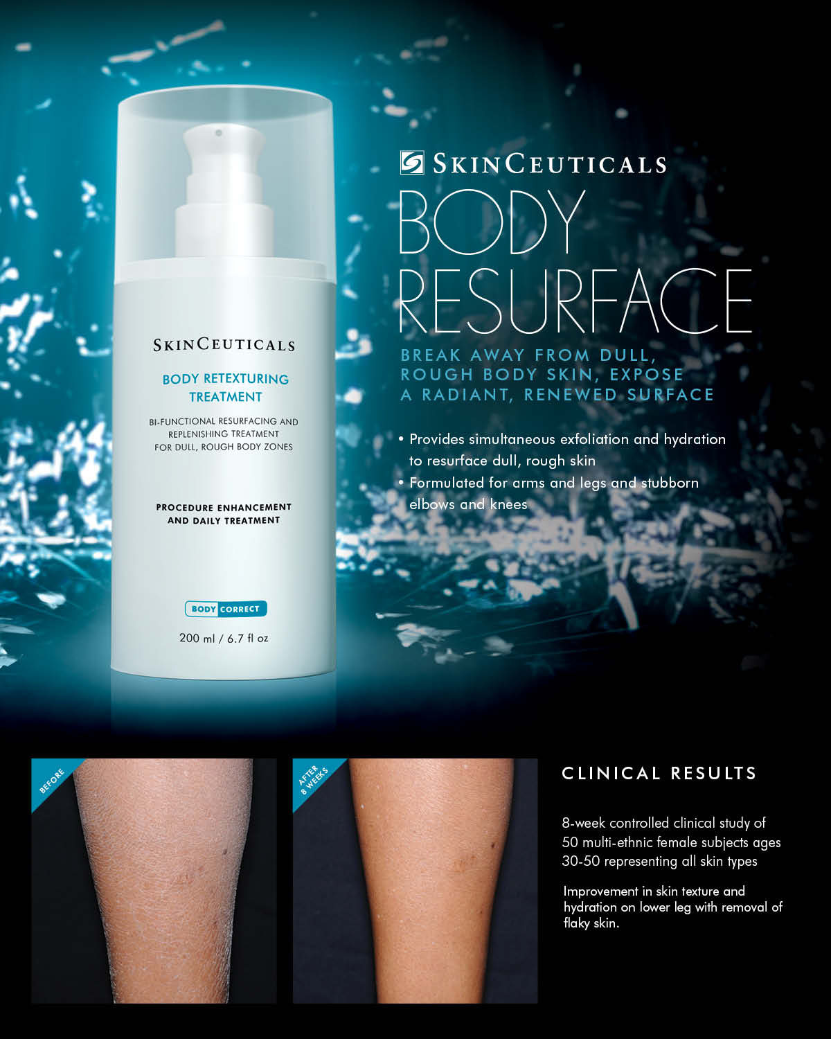 SkinCeuticals Body Correct Line Now Available at Skin Envy - News ...
